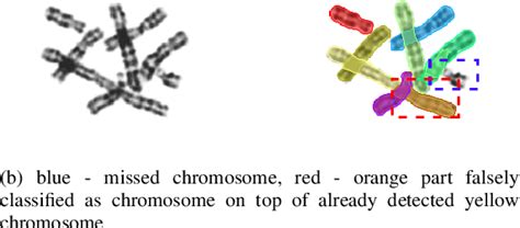 Figure 2 From Deep Learning Pipeline For Chromosome Segmentation