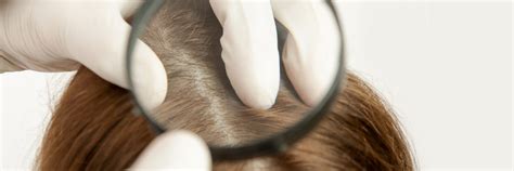 Main Causes Of A Problem Scalp