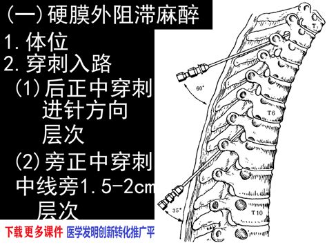 腰麻穿刺层次3d图 腰椎穿刺真实图片 伤感说说吧