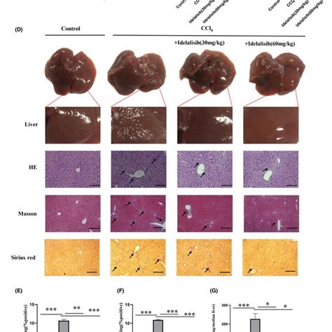Idelalisib Alleviates Liver Fibrosis Induced By Ccl4 In Mice A Time