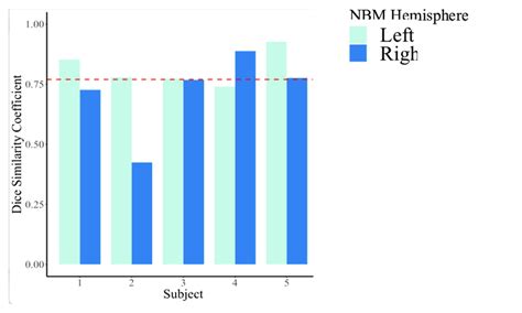 Dice Similarity Coefficients For The Test Retest Reliability Of The Download Scientific Diagram