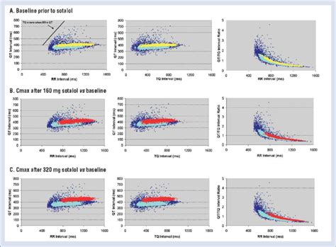Beat To Beat QT RR And TQ Interval Relationships From A Single Healthy Download Scientific