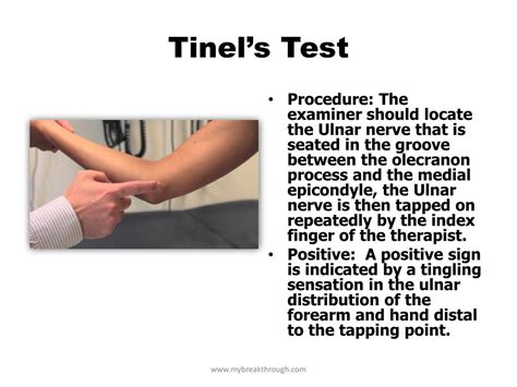 Ppt Common Elbow Injuries And What To Do About Them Powerpoint