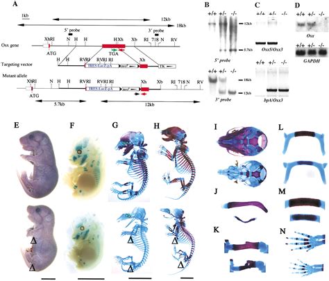 The Novel Zinc Finger Containing Transcription Factor Osterix Is