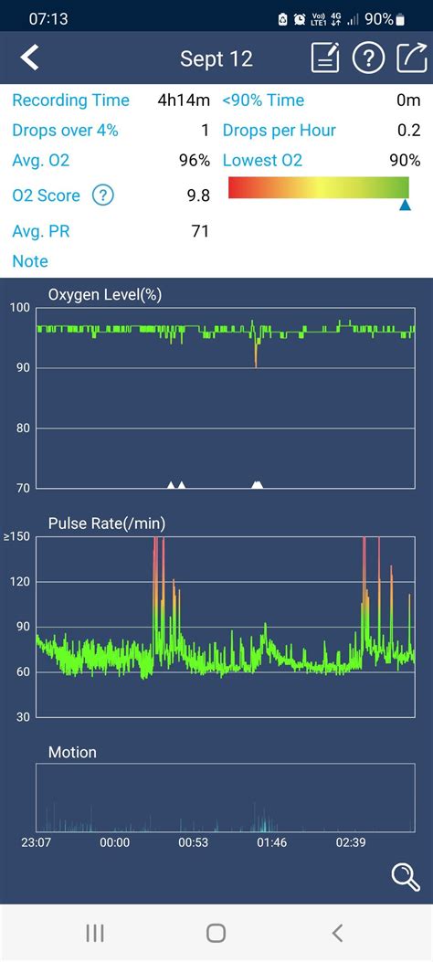 O2 Level Overnight With Cpap R Cpap