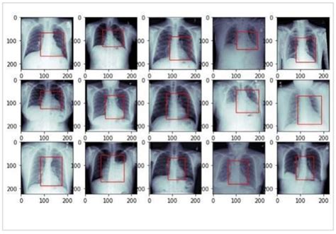 How Well Sophisticated Convolutional Neural Networks Cnns Perform… Bio Algorithms And Med