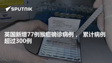 英国新增77例猴痘确诊病例， 累计病例超过300例 2022年6月7日 俄罗斯卫星通讯社
