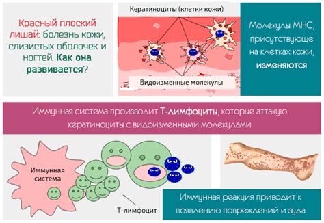 Мазь от лишая на коже у человека (серная) и крем