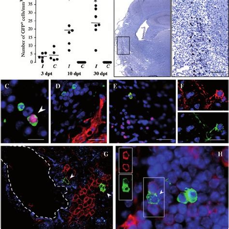 Reduction Of Astroglial Scar Formation Quantitative Analysis Of The