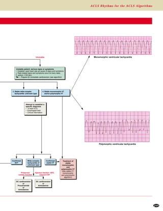 Ecg For Acls PDF