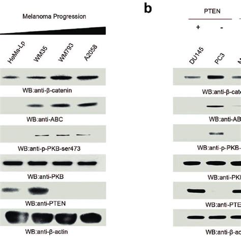 Cellular Levels And Localization Of β Catenin And Abc Are Altered By
