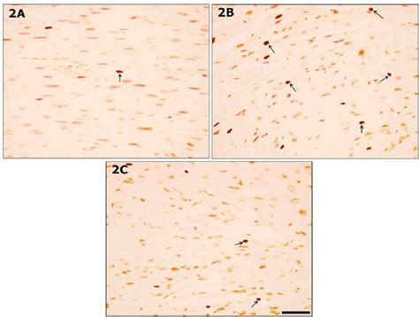 Tunel Detection Of Apoptotic Cells In Control A Dox Treated B And Download Scientific