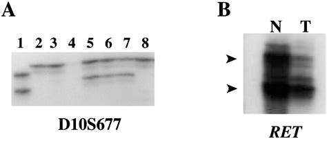 Molecular Genetic Analysis Of A Primitive Neuroectodermal Tumor Arising