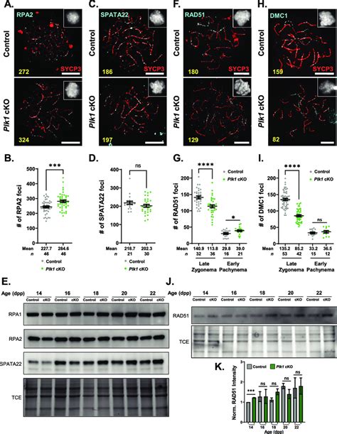 Deletion Of Plk1 In Mouse Spermatocytes Results In Abnormal Early Dna Download Scientific
