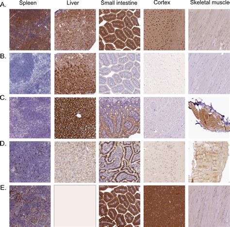 Images Showing Protein Expression Profiles Based On Five Antibodies