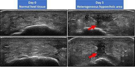Figure 9 From The Correlation Between Sub‐epidermal Moisture