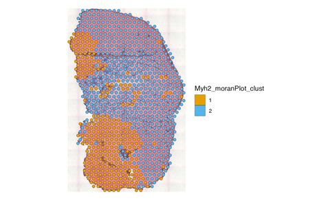 Spatial Visium Exploratory Data Analysis • Voyager