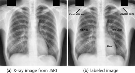 a x ray image from jsrt b labeled image download scientific diagram