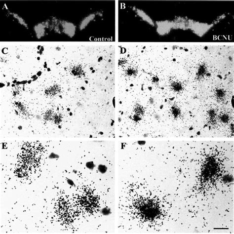 Glutathione Reductase Activity In Striatum And Substantia Nigra Download Scientific Diagram