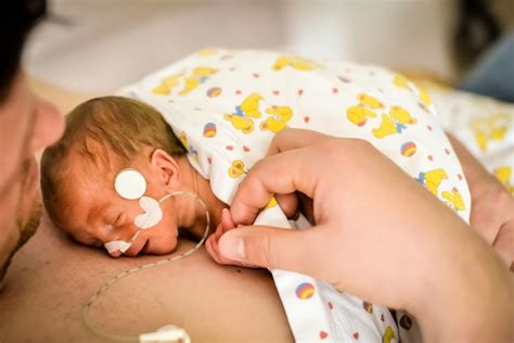 Cerebral Function Monitoring Guideline East Of England