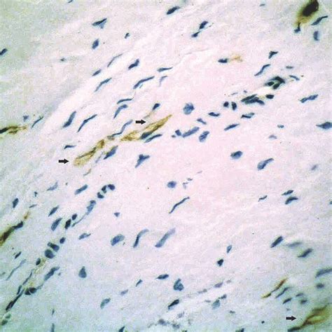 Helmholtz Electric Double Layer Model A And Gouy Chapmans Model B Download Scientific Diagram