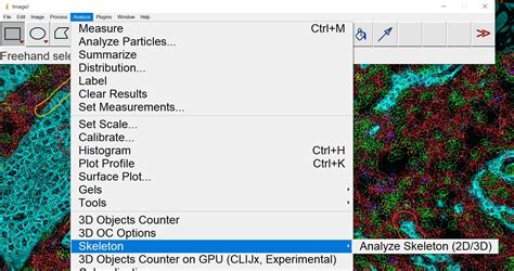 Unable To Installrun Analyzeskeleton In Imagej Extension Within Qupath