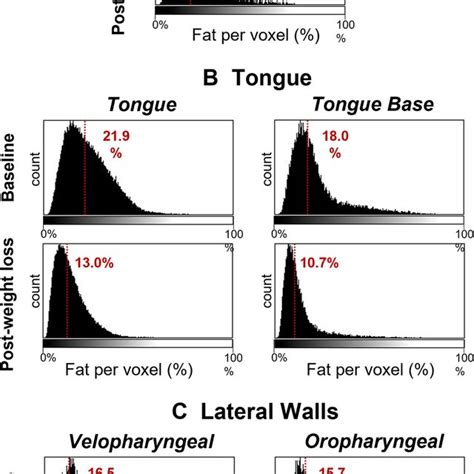 Volumetric Analysis Of Upper Airway Structures And Intra Tissue Fat Download Scientific Diagram