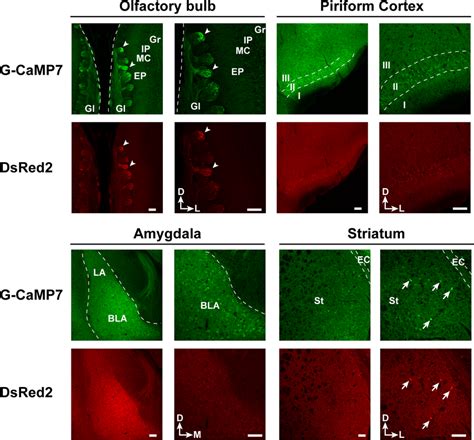 Transgene Expression In Brain Areas Outside The Neocortex And