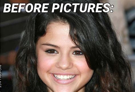 The Dirt Did You Know Selena Gomez Has Veneers
