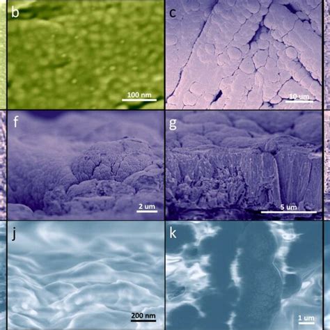 Morphology And Microstructure Of The Multilayer Auznopmma System On