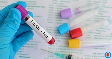 Everything We Need To Know About The A C Test Diabetes Health Page