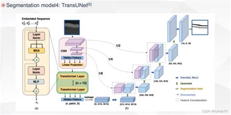 Miccai2022 Goals 挑战赛总结 Csdn博客
