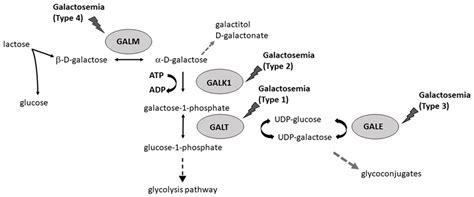 Sintomas De Galactosemia