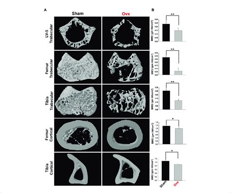 Micro Ct Analysis Of Trabecular And Cortical Regions Of Lumbar