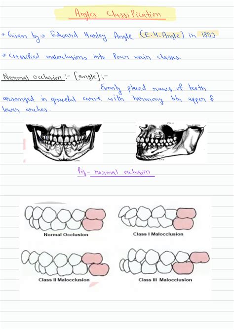 Solution Angles Classification Of Malocclusion Studypool