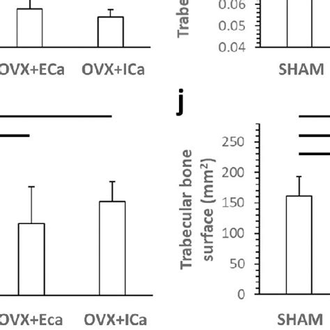 Quantitative 3d Analyses Of Cortical A D And Trabecular Bone Tissues