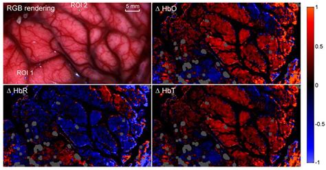 Medical Hyperspectral Imaging For Surgery And Diagnostics Imec
