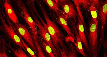 Focus On RNA Secondary Structure RNA Seq Blog