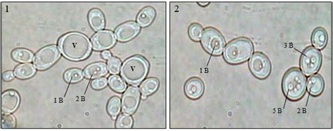 Yeast Cells Under A Microscope