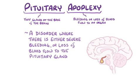 Apoplexy Symptoms
