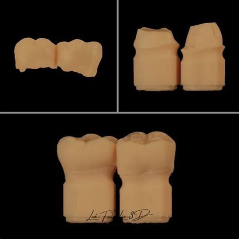 Купити Фотополімерна смола Resione для стоматологічних моделей D01