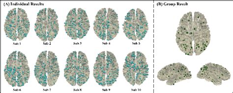Figure 2 From A Novel Multi Modality Framework For Exploring Brain