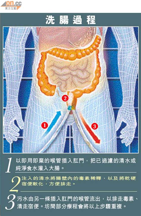 Sun特搜洗腸無王管周一嶽失職 太陽報