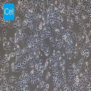 Caov 3 人卵巢癌细胞 原代细胞 Str细胞 细胞培养基 镜像绮点生物