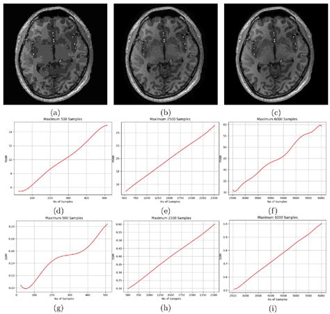 Figure 1 From Fast Fractal Coding Of Mri Images Using Deep