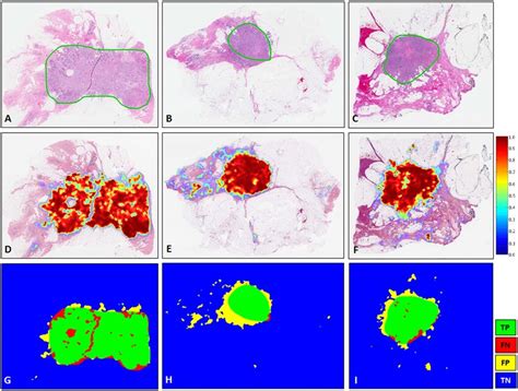 Example Results For The Convnet Hup Classifier On The Cinj Validation Download Scientific