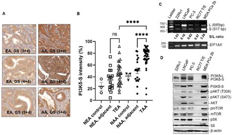 Pi3kδ S Splice Isoform Is Overexpressed In Aa Pca With Highly Activated
