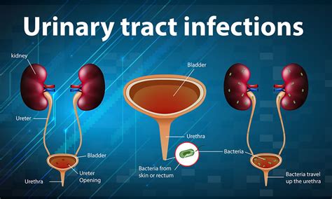 Icd 10 Codes For Erectile Dysfunction A Complete Guide Icd 10 Codes For Erectile Dysfunction A Complete Guide