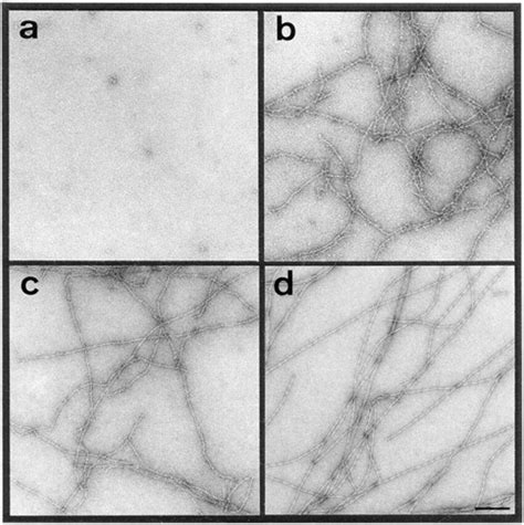 Negatively Stained F Actin Filaments Imaged By Ctem After 0 A 5 B Download Scientific