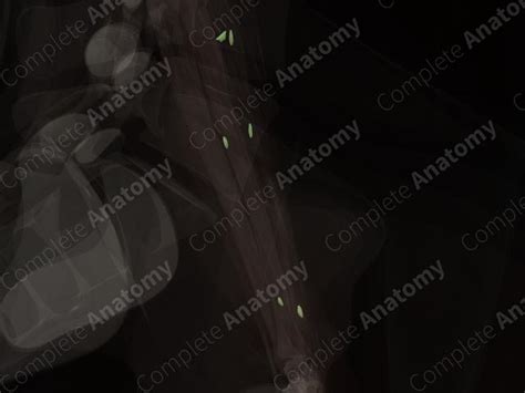 Lymph Nodes Of Forearm Left Complete Anatomy